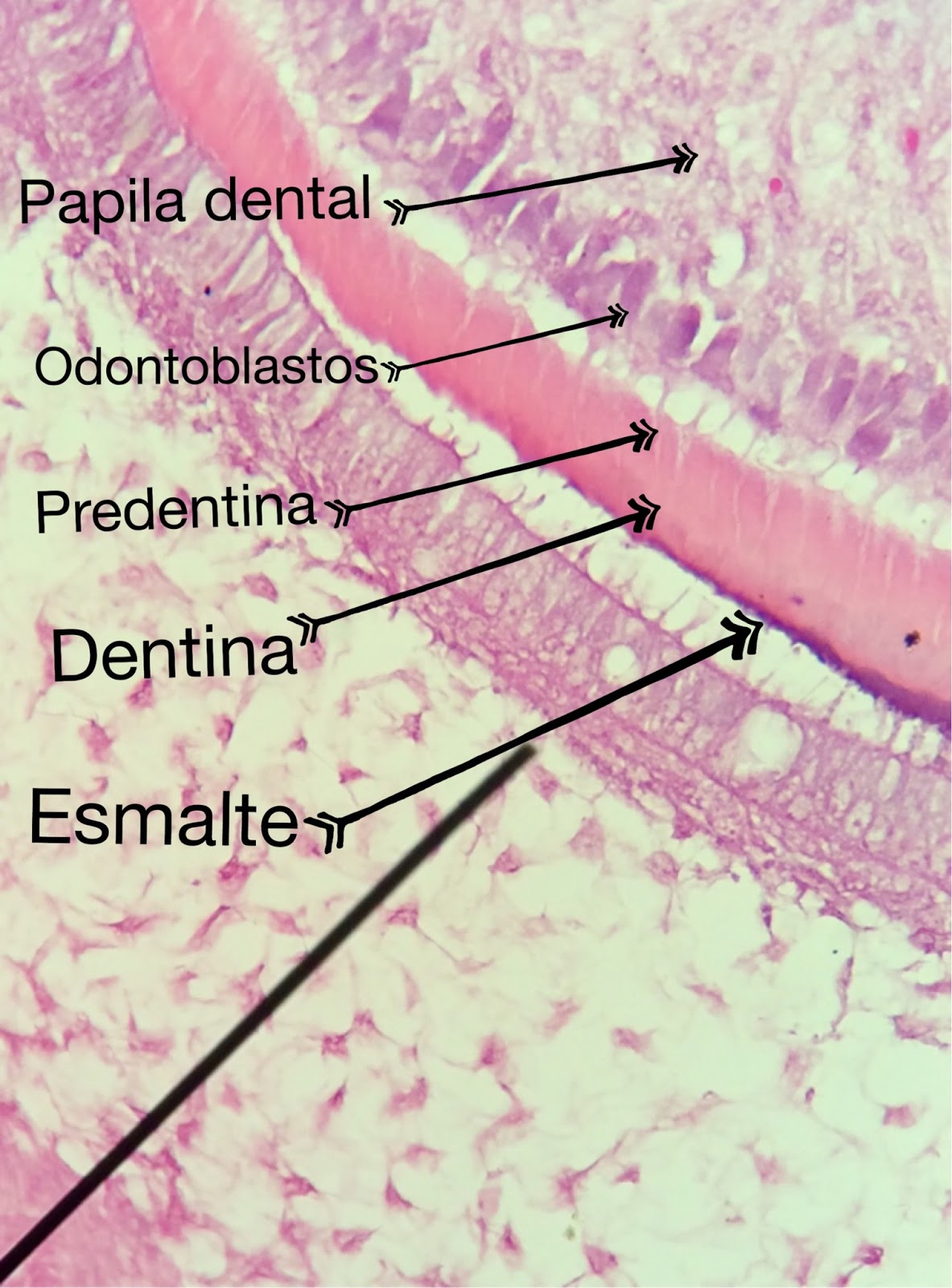 Complejo Dentino-Pulpar on emaze