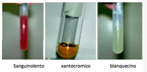 RAE: Describir los principios básicos del estudio del LCR on emaze