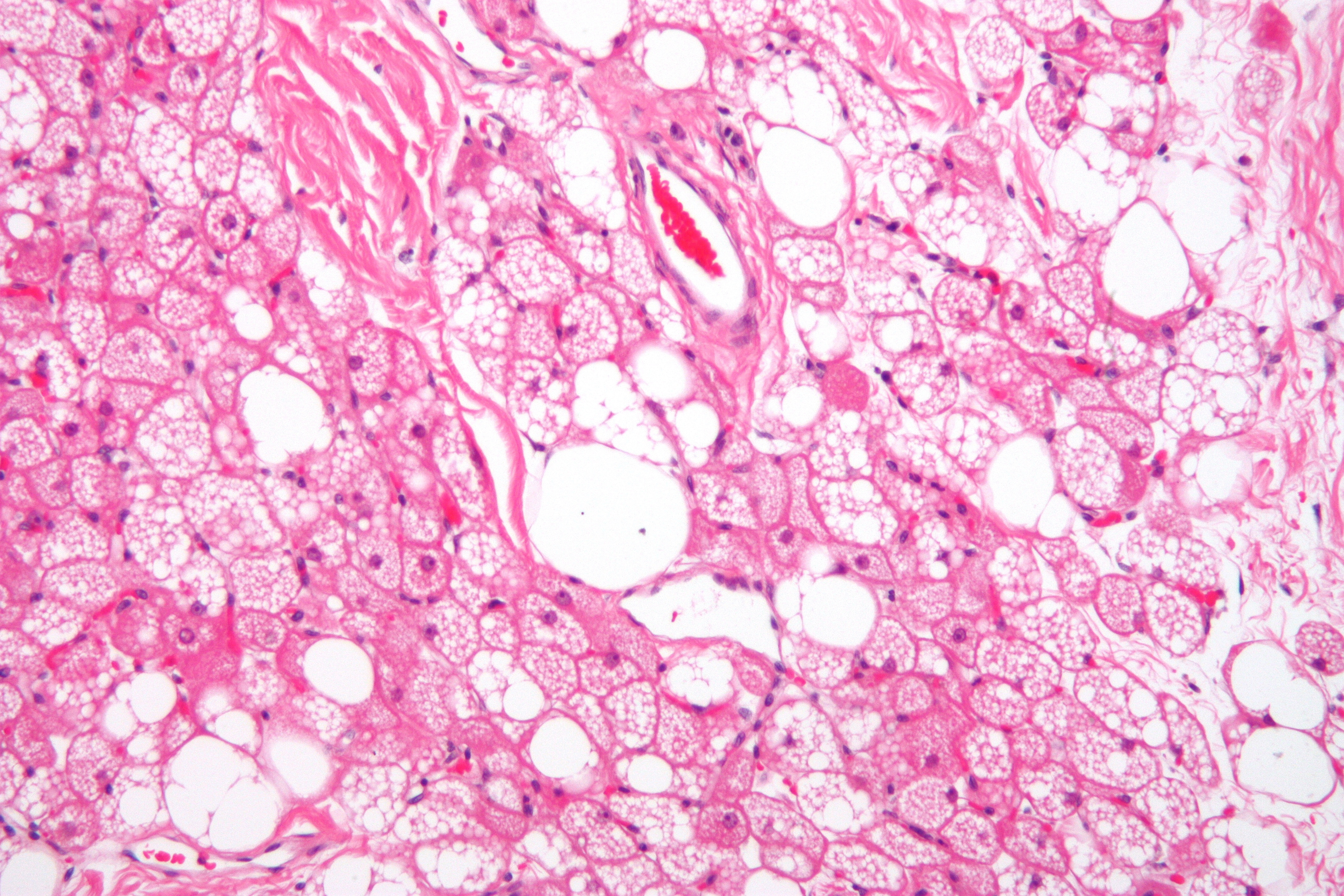 adipose tissue at emaze Presentation