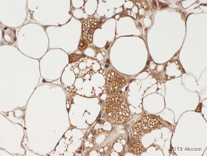 adipose tissue on emaze