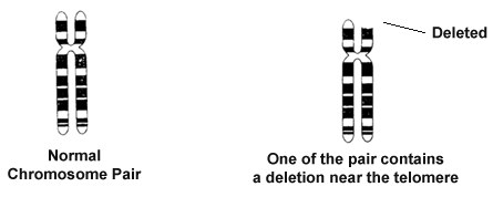 Cri du chat syndrome on emaze