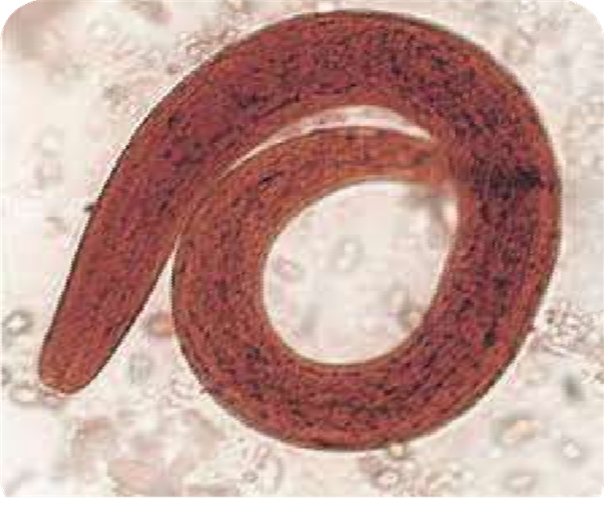 STRONGYLOIDES STERCORALIS on emaze