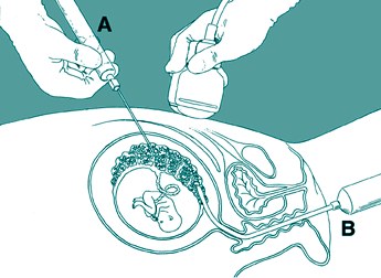 Antepartal Test at emaze Presentation