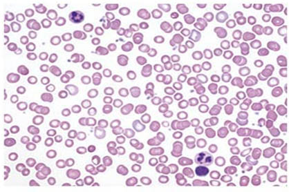 Fichero Hematología copy1 on emaze