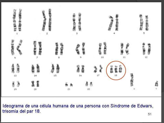 TRISOMÍAS 13 Y 18