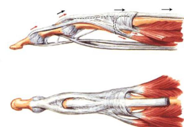 LNP y Tendones copy1 on emaze