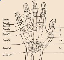 LNP y Tendones copy1 on emaze