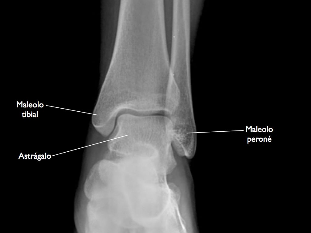 ANATOMIA RADIOLOGICA at emaze Presentation