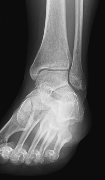 ANATOMIA RADIOLOGICA on emaze