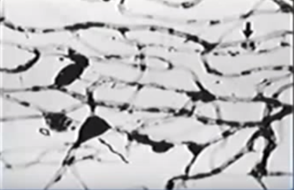 caso clínico 7 on emaze