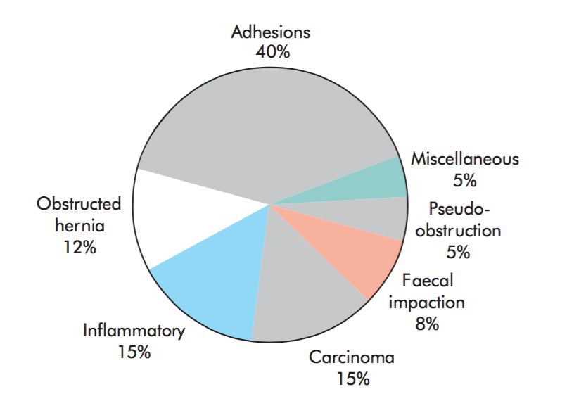 Intestinal Obstruction on emaze