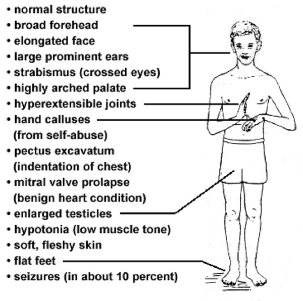 efa0ed9f-4d89-4334-9db6-640a4d384e2d.jpg (600×596)(이미지 포함)