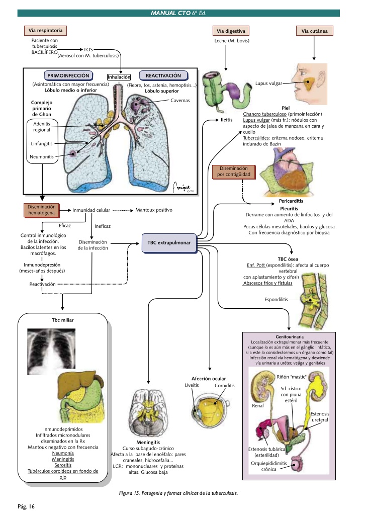 TBC PERINATAL amaia.pptx at emaze Presentation