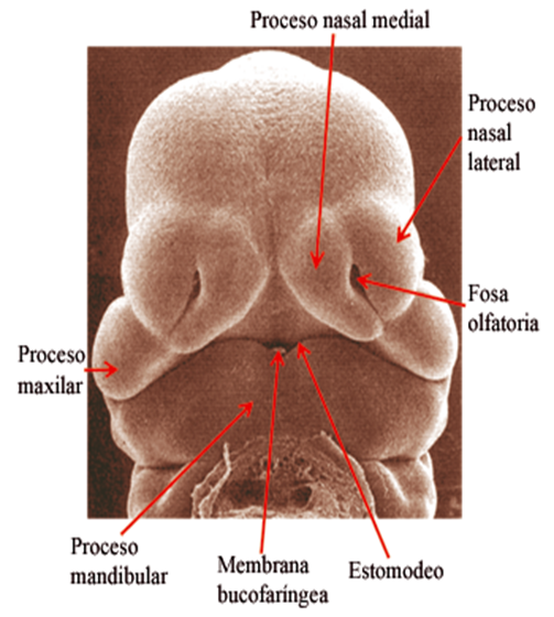 Desarrollo de la Cabeza: Porción Neurocraneal y Porción Visceral on emaze