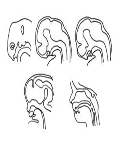 Desarrollo de la Cabeza: Porción Neurocraneal y Porción Visceral on emaze