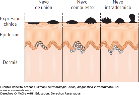 NEVUS MELANOCITICOS on emaze