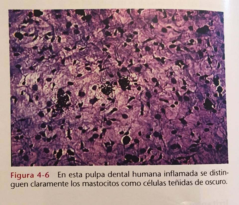 dx lesiones pulpares on emaze