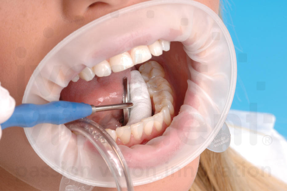 dx lesiones pulpares on emaze