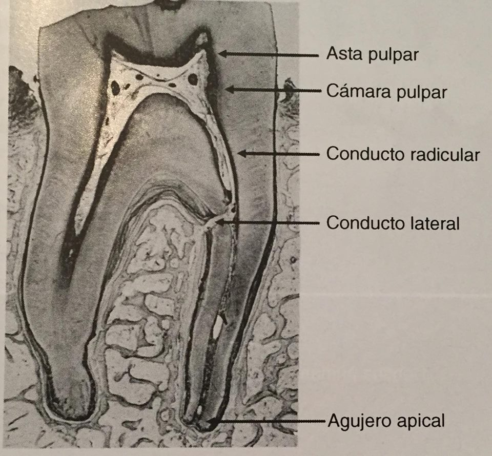 dx lesiones pulpares on emaze