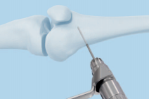 PELVIS copy1 on emaze