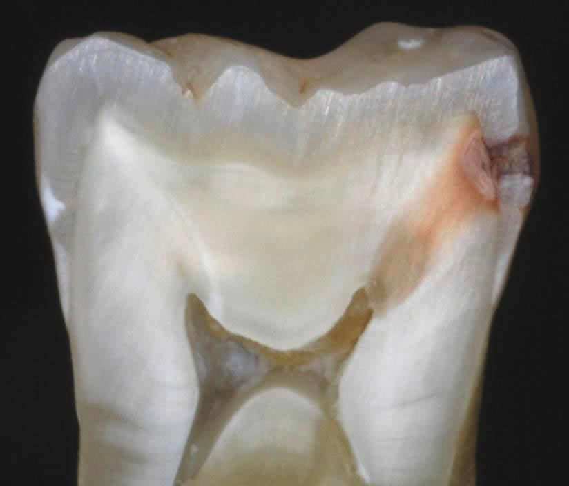 complejo dentino-pulpar on emaze