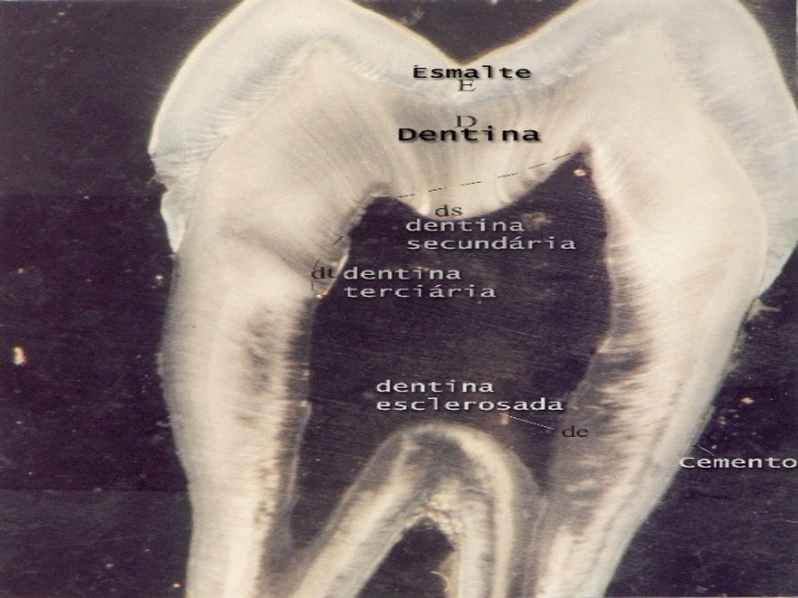 complejo dentino-pulpar on emaze