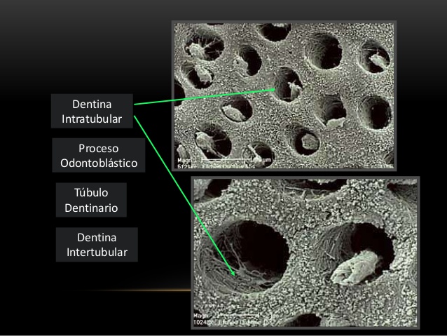 complejo dentino-pulpar on emaze