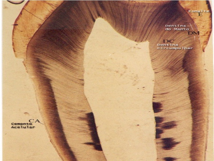 complejo dentino-pulpar on emaze
