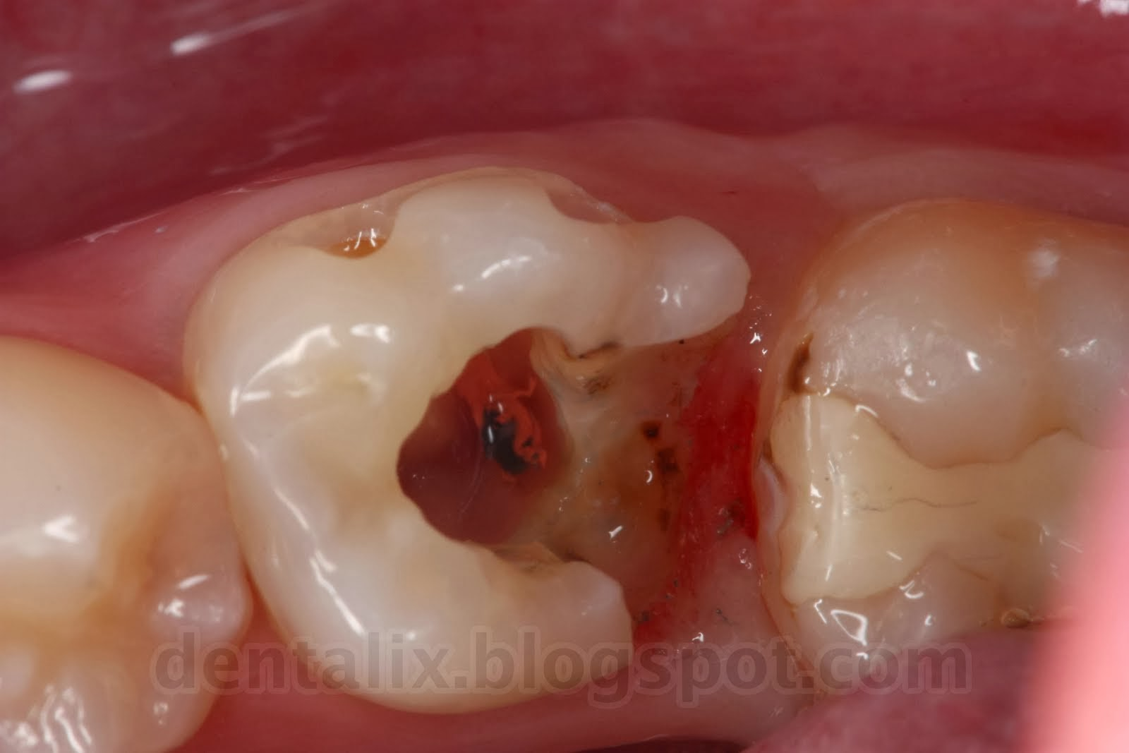 complejo dentino-pulpar at emaze Presentation