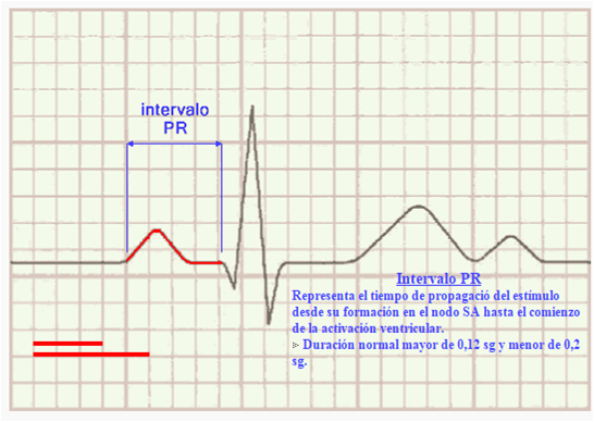 ELECTROCARDIOGRAMA Y ARRITMIAS on emaze
