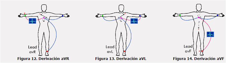 ELECTROCARDIOGRAMA Y ARRITMIAS on emaze