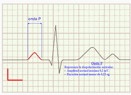 ELECTROCARDIOGRAMA Y ARRITMIAS on emaze