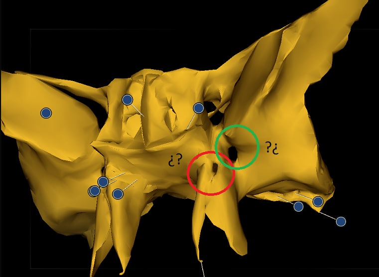 Region cigomatica on emaze