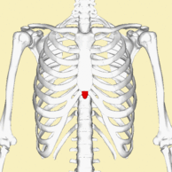 Angina estable crónica on emaze