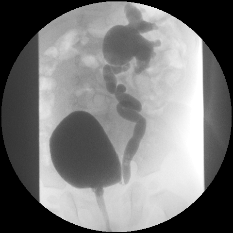 UTI Contraversies.pptx on emaze