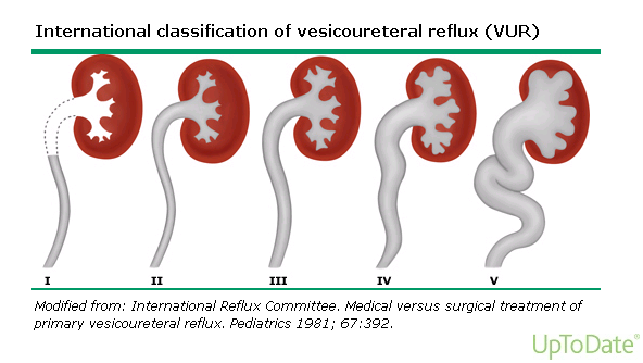 UTI Contraversies.pptx on emaze