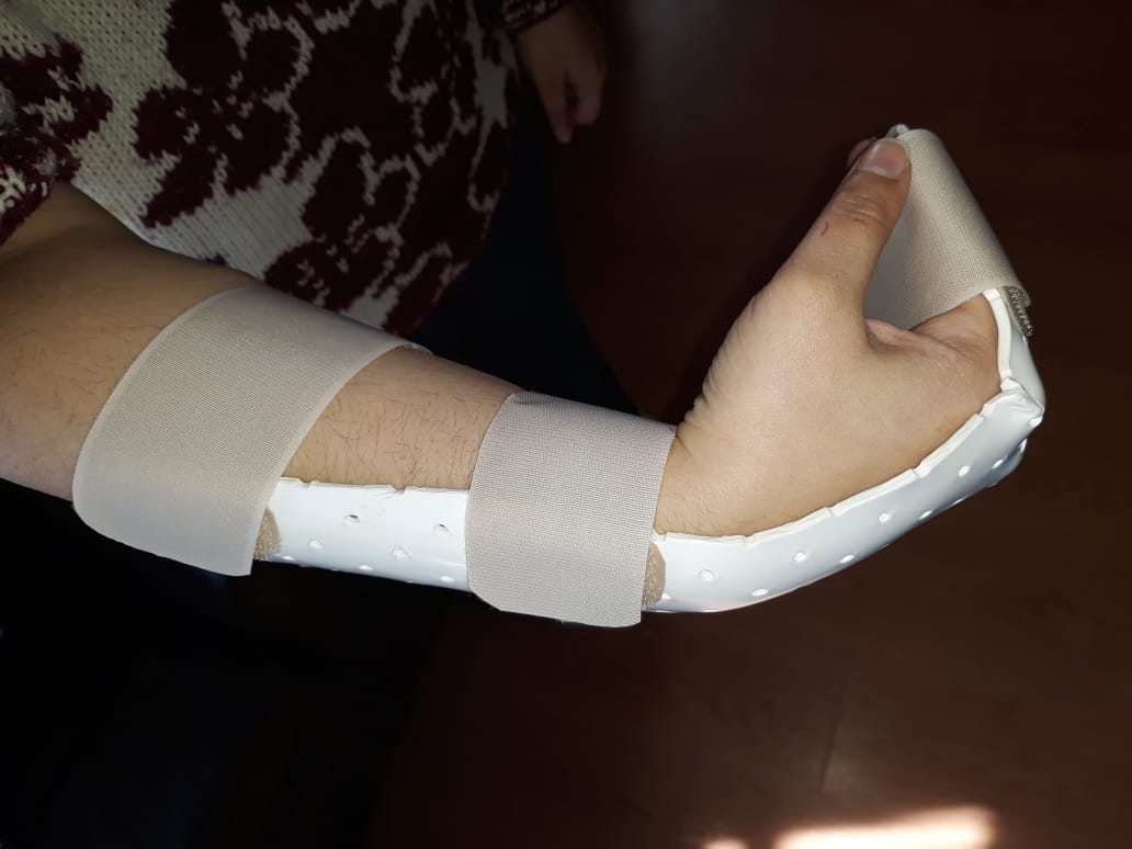 MANUAL DE ORTESIS at emaze Presentation