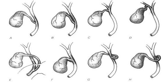 SÍNDROME ICTERICO on emaze