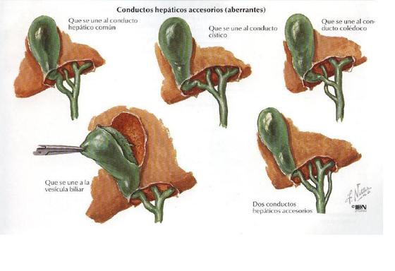 Colecistitis on emaze