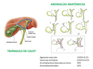 Colecistitis on emaze