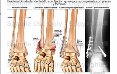 El tobillo anatomía trauma on emaze