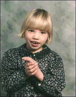 Síndrome de delecion on emaze