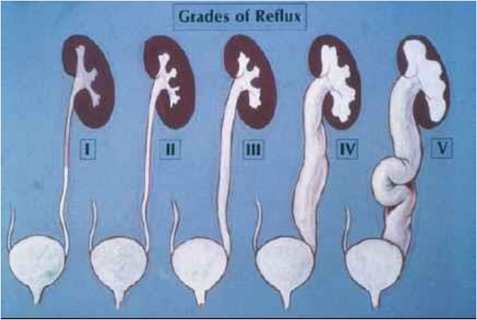Urologia- reimplante on emaze