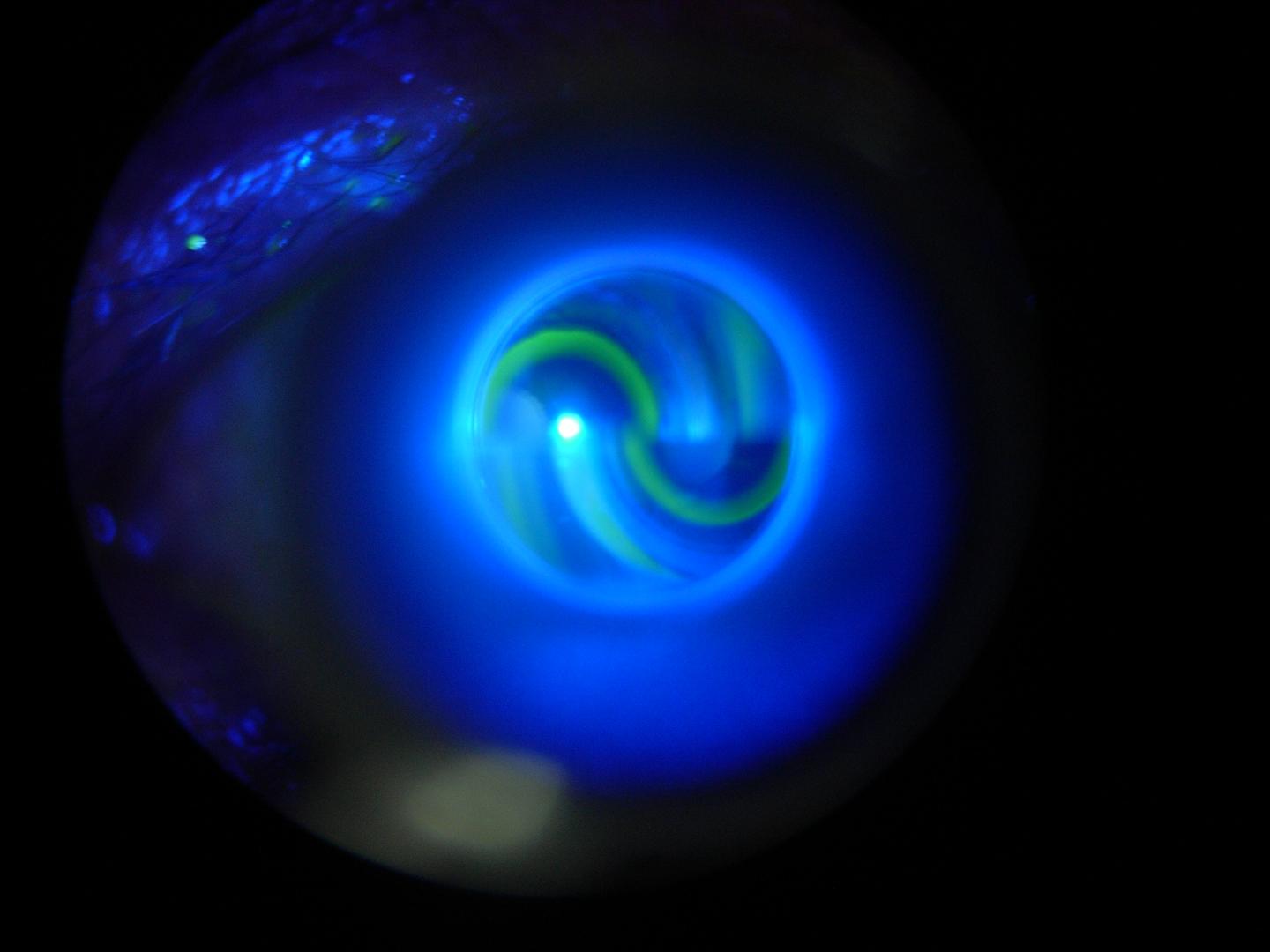 Glaucoma on emaze
