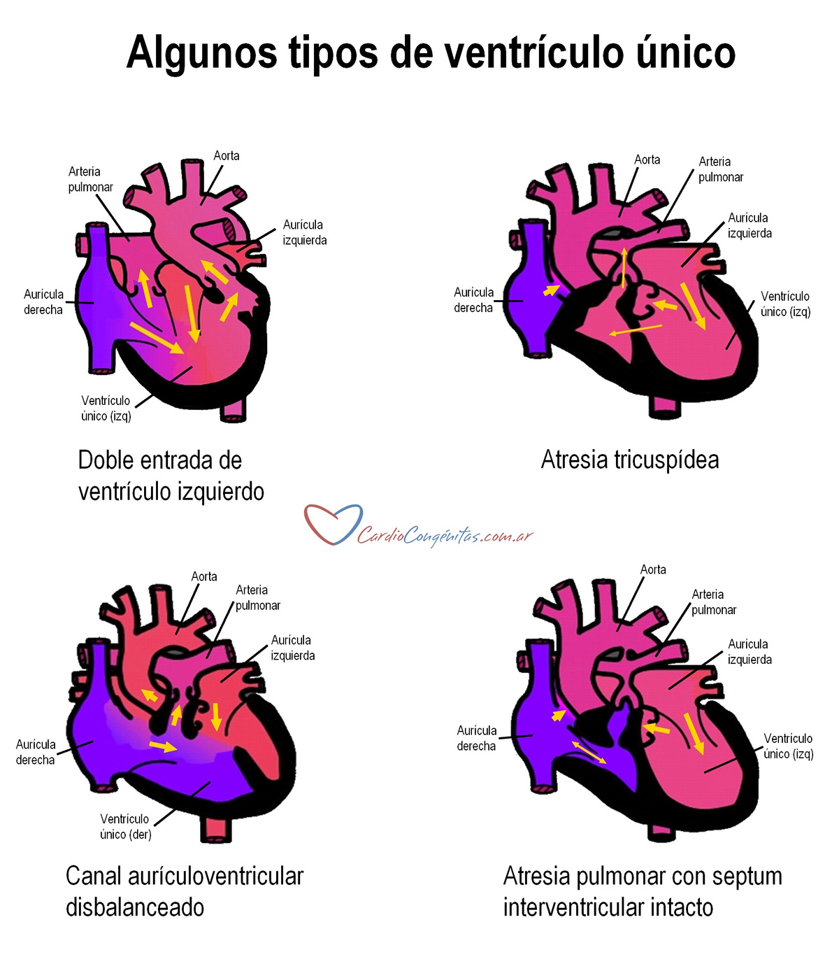 VENTRÍCULO ÚNICOSe on emaze