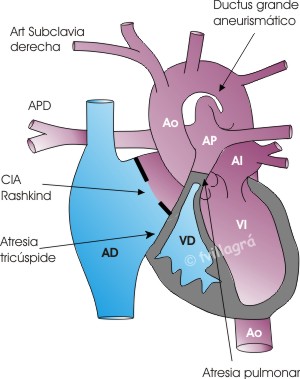 VENTRÍCULO ÚNICOSe on emaze