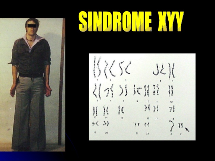 Super hombre o sindrome xyy on emaze