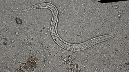 strongyloides stercoralis at emaze Presentation