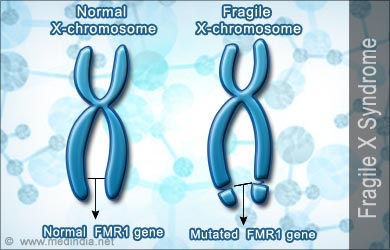 Fragile X Syndrome at emaze Presentation