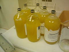 paracentesis on emaze